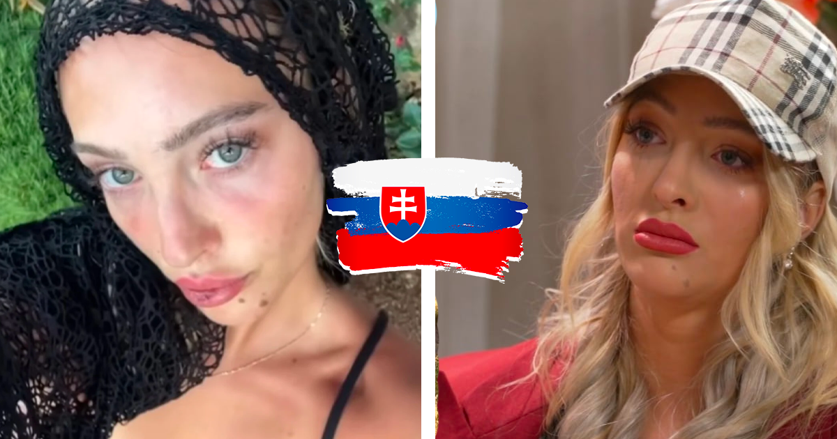 Frederiku z Ruže pre nevestu napadla na dovolenke žena. Takýto je dôvod