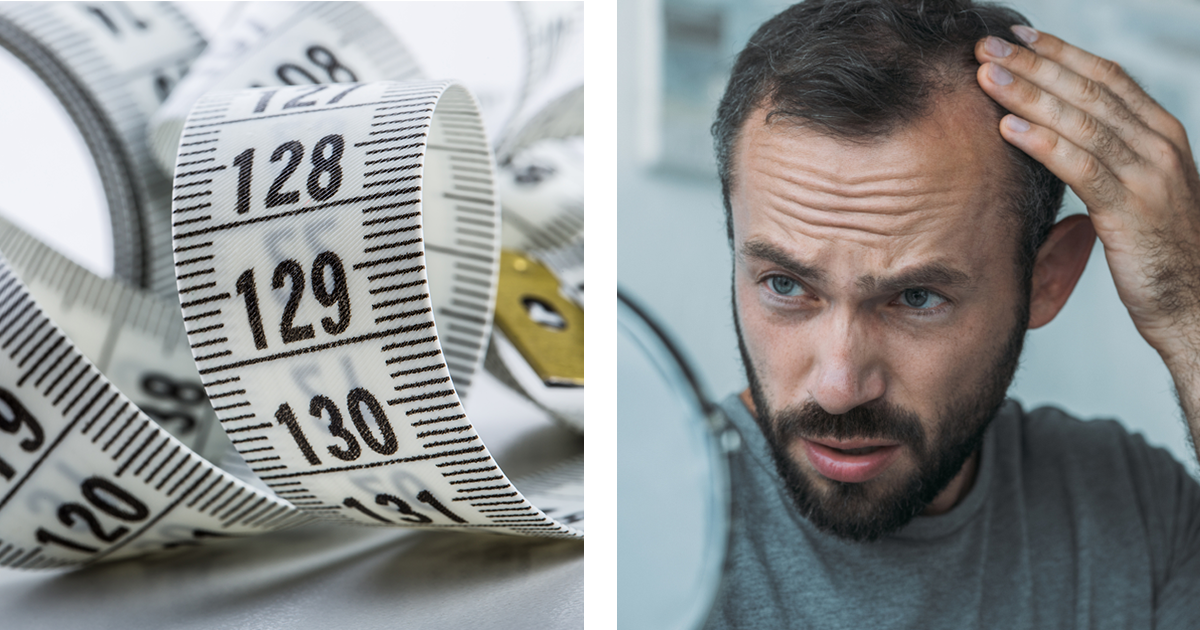 Ak chceš vedieť, či budeš plešatý, zmeraj si tieto dva prsty - EMEFKA