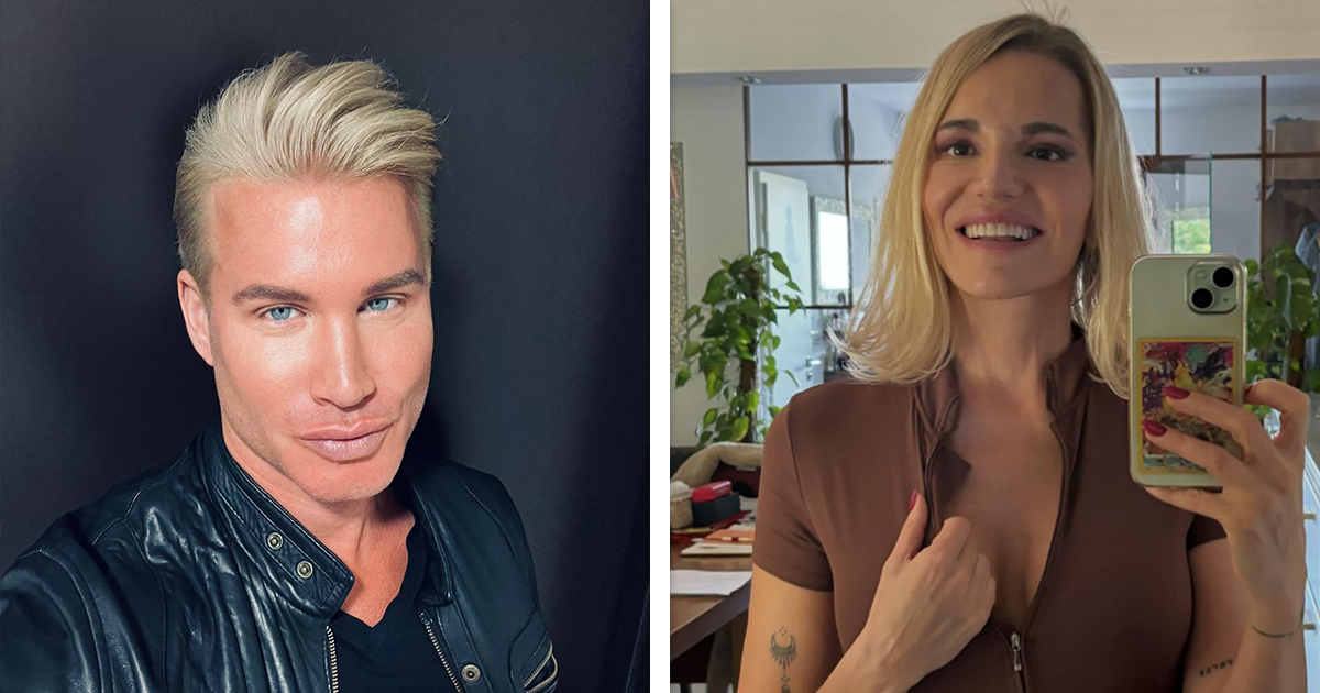 Dara Rolins dostala výsmech za plastiku. Takto to okomentoval odborník